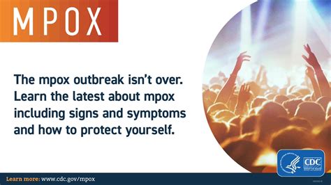 CDC On Twitter CDC Is Updating Mpox Information For Summer Events