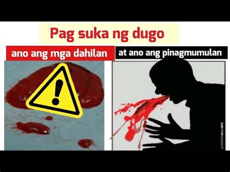 Pagsuka Ng Dugo Mga Dahilan Alamin Blood Vomiting Causes And