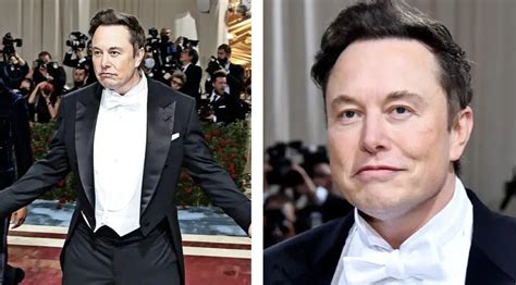 Elon Musk Before And After Hair Transplant Hair System