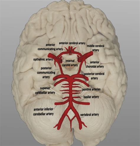 Figure Vertebrobasilar System Image Courtesy S Bhimji MD