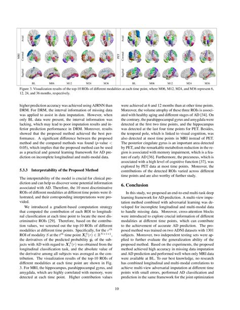 multi view imputation and cross attention network based on incomplete longitudinal and multi