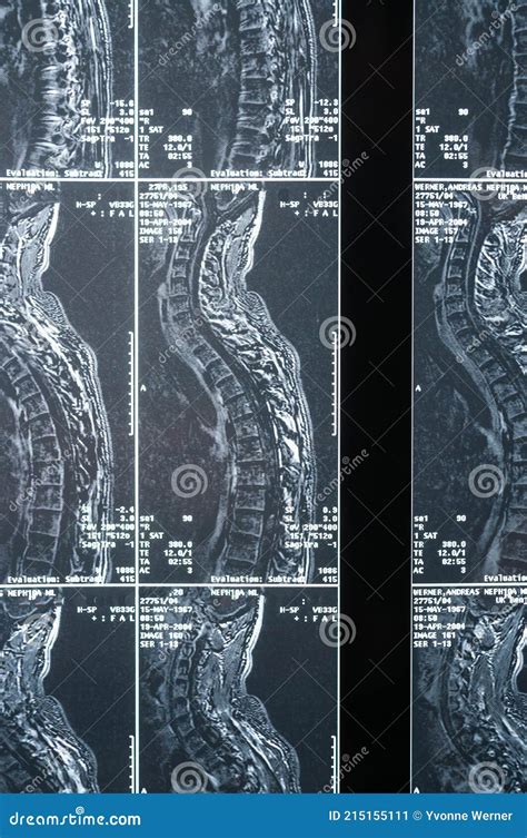 Magnetic Resonance Imaging MRI Computed Tomography X Ray Image Stock