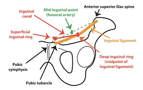 Inguinal Hernia Examination OSCEstop OSCE Learning