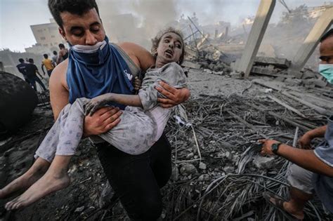 イスラエルの空爆を受けたパレスチナ自治区ガザでけがをガザ衝突 写真特集時事ドットコム