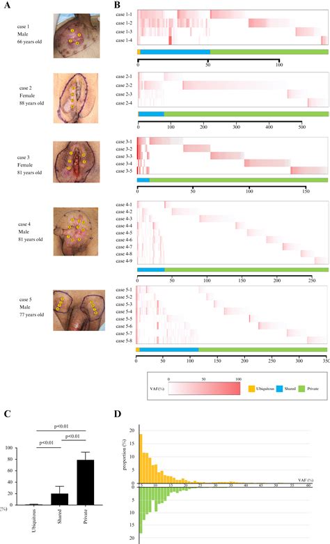 JLE European Journal Of Dermatology Genetic Intratumour