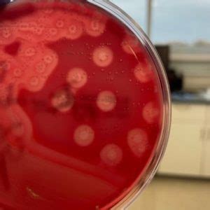 Anaerobic Culture Tips NDSU VDL