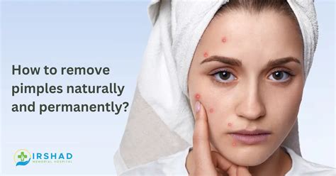 How To Remove Pimples Naturally And Permanently IMH