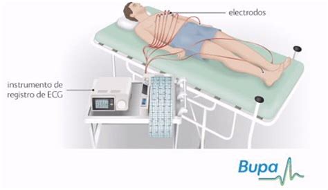 Qué es un electrocardiograma