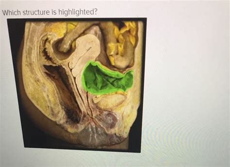 Solved Which Structure Is Highlighted O External Urethral Chegg