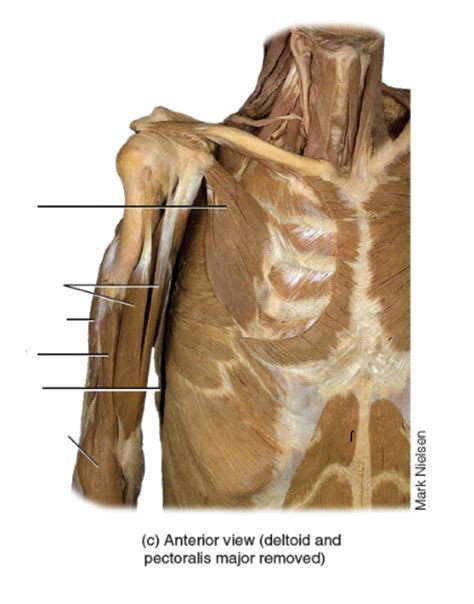 Anterior Arm Cadaver Muscles Diagram Quizlet
