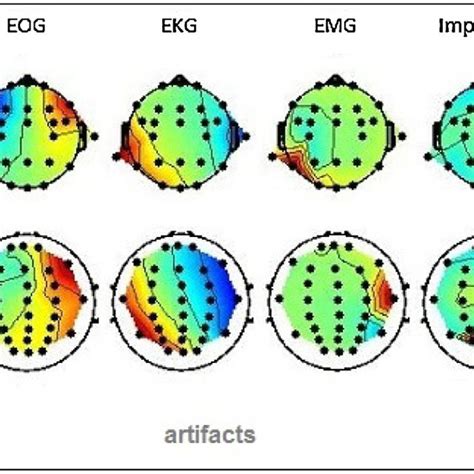 pdf eeg artifact elimination by extraction of ica component features using image processing