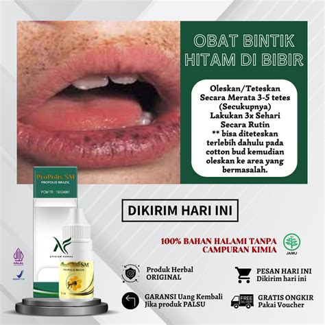 Jual Obat Bintik Hitam Di Bibir Penghilang Bintik Hitam Di Bibir