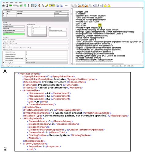 an example of pathology report data extraction using extract systems download scientific