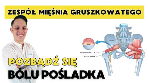 Zespól Mięśnia Gruszkowatego 4 Ćwiczenia Likwidujące Ból YouTube