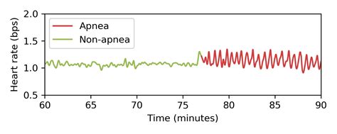 apnea ecg detect sleep apnea using heart rate data from wearable devices