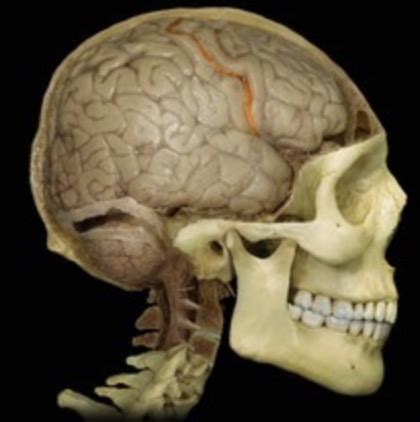 Fms Neuro Flashcards Quizlet