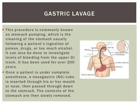 Digestive System Procedures