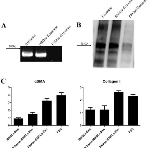 The Nucleic Acid Component Present In BMSCs Exo Can Play A Role In