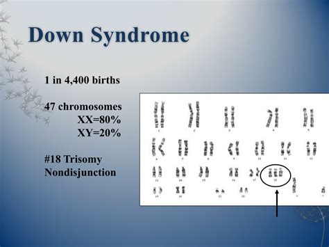 Ppt Nondisjunction Disorders Powerpoint Presentation Free Download Id9655984