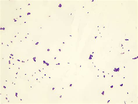 Micrograph Staphylococcus Aureus Gram Stain 1000x P000028 OER Commons