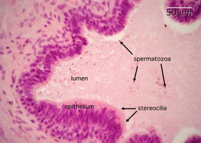 Vas Deferens Histology Vas Deferens Labels Histology Slide