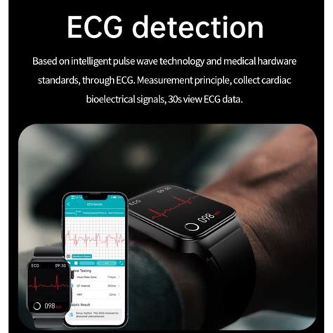 Montre intelligente E500 pour homme ECG PPG glycémie température