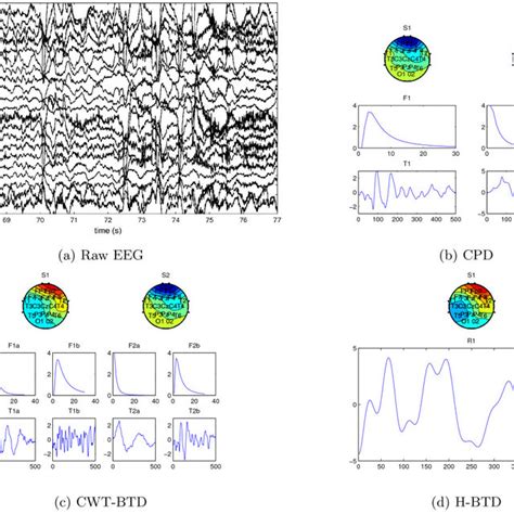 ictal eeg and its tensor decompositions in patient 3 a a segment of download scientific