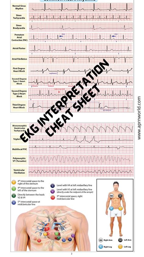 EKG Interpretation Cheat Sheet 12 Pages Ekg Interpretation Ekg