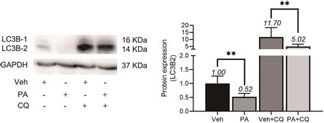 USP10 Alleviates Palmitic Acid Induced Steatosis Through Autophagy In