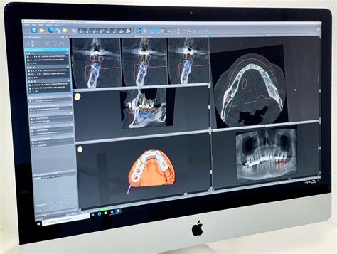 Mascha Rosskopf Mkg Oralchirurgie In Kempten Allg U Mund