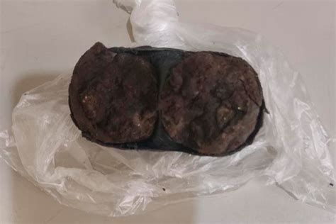 Agentes Do Deppen Interceptam Entrada De Drogas Uso Do Body Scan Em