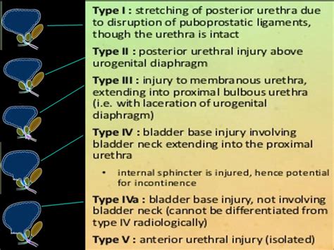 Figure Types Of Urethral Injuries Image Courtesy S Bhimji MD