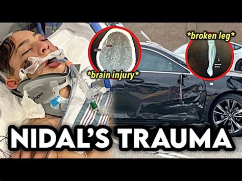 Nidal Wonders Full TRAGIC Accident Story YouTube