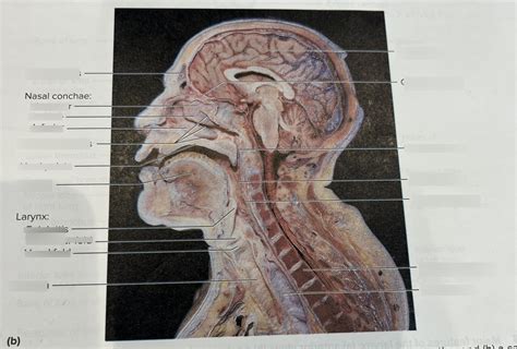 Sagittal Section Of The Features Of The Upper Respiratory System A