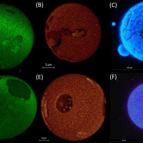 Confocal Microscopy Z Stack D Visualizations Of Guvs From Popc C P