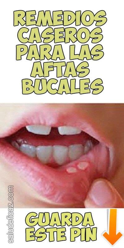 Remedios Caseros Super Efectivos Para Curar Las Aftas Bucales