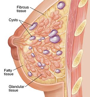 Common Benign Lumps University Hospitals