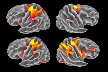 Types Of Mri Scans Mri Scan Articles Deep Medical Centre