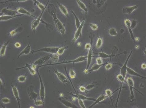 under the microscope dendritic cells feb 2022