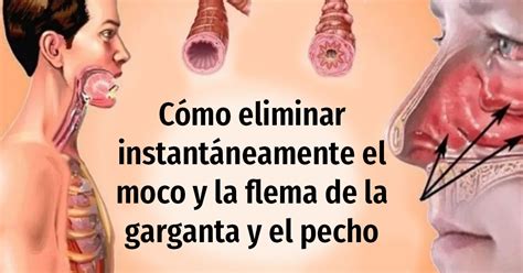Pin En Medicina