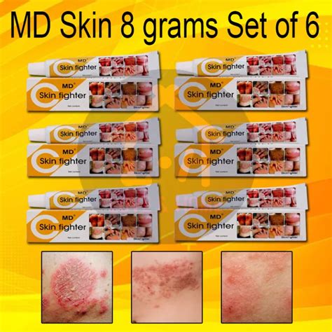 COD Original MD Skin Fighter Cream For Skin Allergies Or Fungis 8g Set