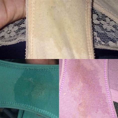 Normal Discharge On Underwear