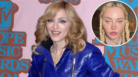 What Happened To Madonnas Face A Look Into Her Plastic Surgery As