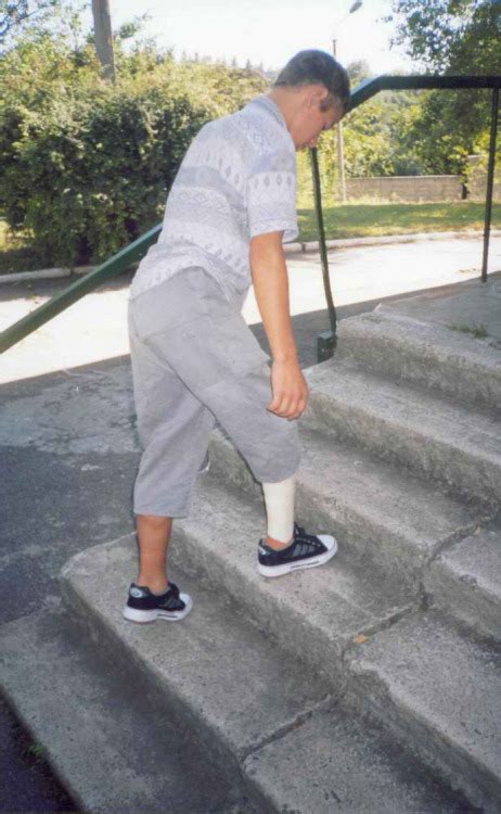 One Legged Vitalys Photoset Tumbex