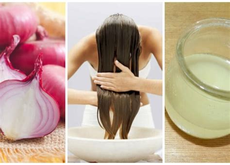 Introducir 64 Imagen Recetas Para La Caida Del Cabello Abzlocal Mx