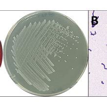Pdf Streptococcus Agalactiae Serotype Vii An Emerging Pathogen