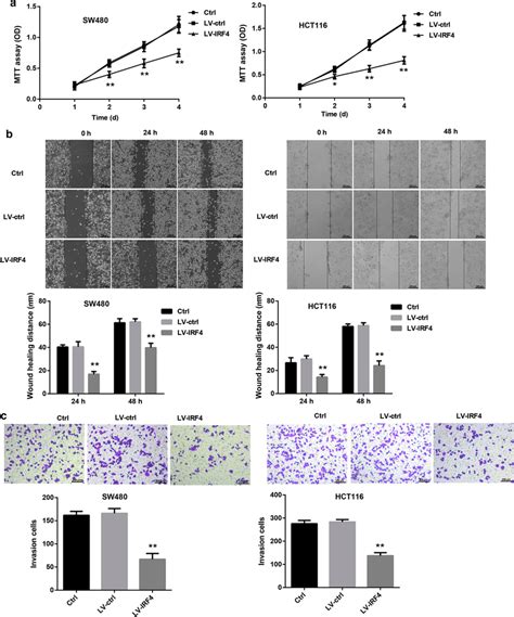 IRF4 Overexpression Repressed Cell Proliferation Migration And