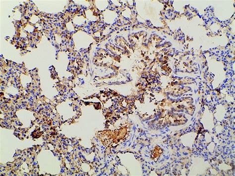 Phospho PI3K p85 alpha Tyr607 Polyclonal Antibody Invitrogen 100 μL