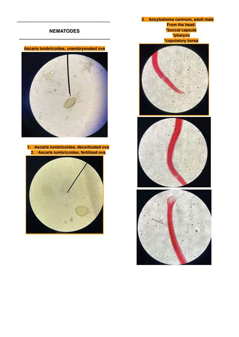 SOLUTION Copy Of Parasitology Trematodes Nematodes Cestodes Practical
