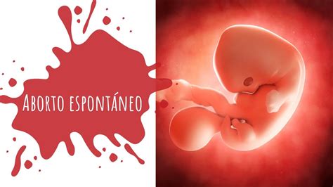 ABORTO ESPONTÁNEO CAUSAS SÍNTOMAS tipos de aborto y TRATAMIENTO